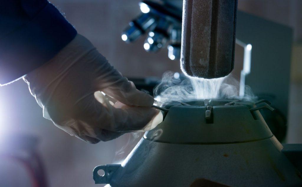 Slow Freeze versus Microfreeze - A National Directory of Sperm Cryobanks